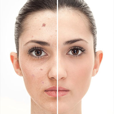 Home - Skin Therapy Day Spa